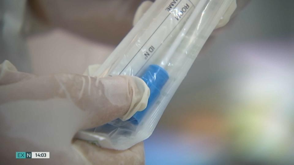 Las pruebas ELISA ganan en fiabilidad frente al COVID-19 | Canal ...