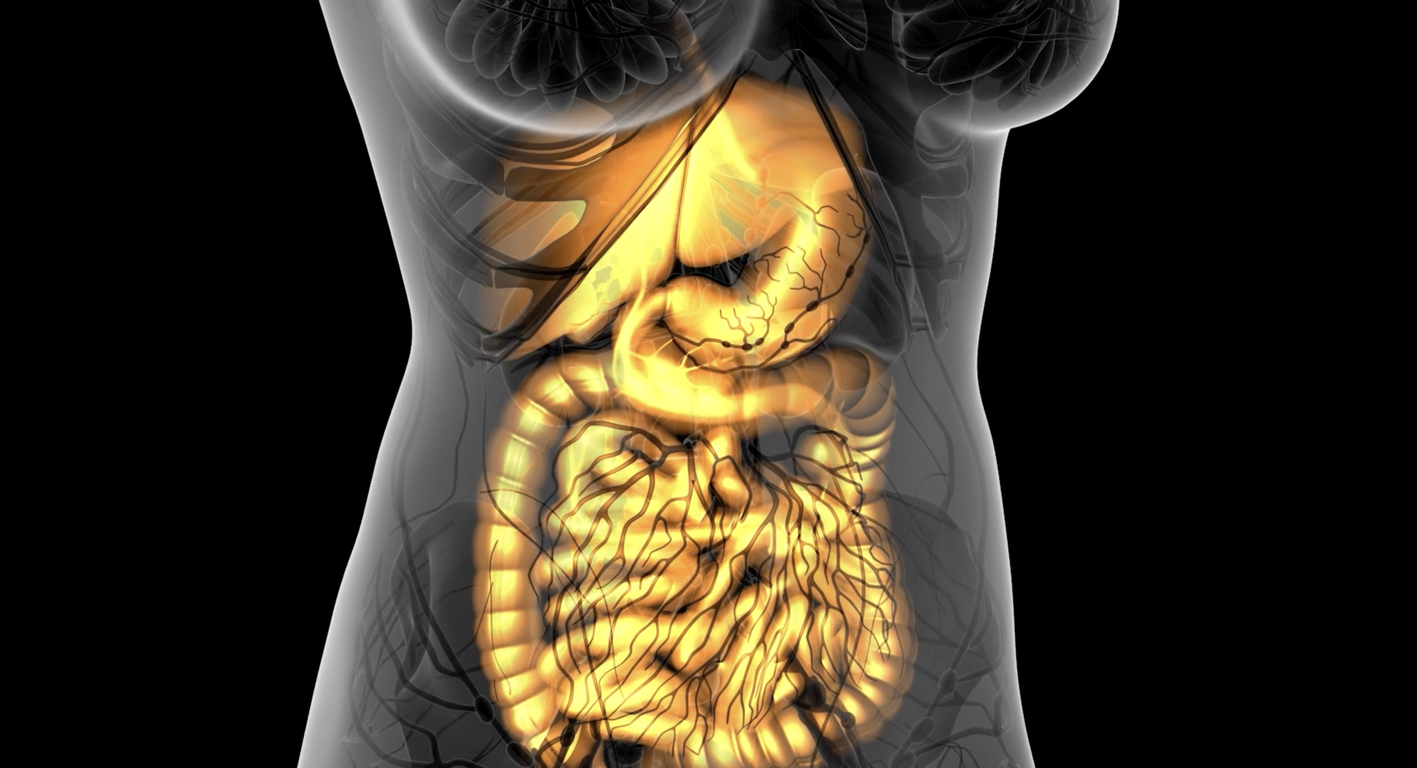 Hernia de hiato: qué es, síntomas y cómo puedes prevenirla | Canal ...